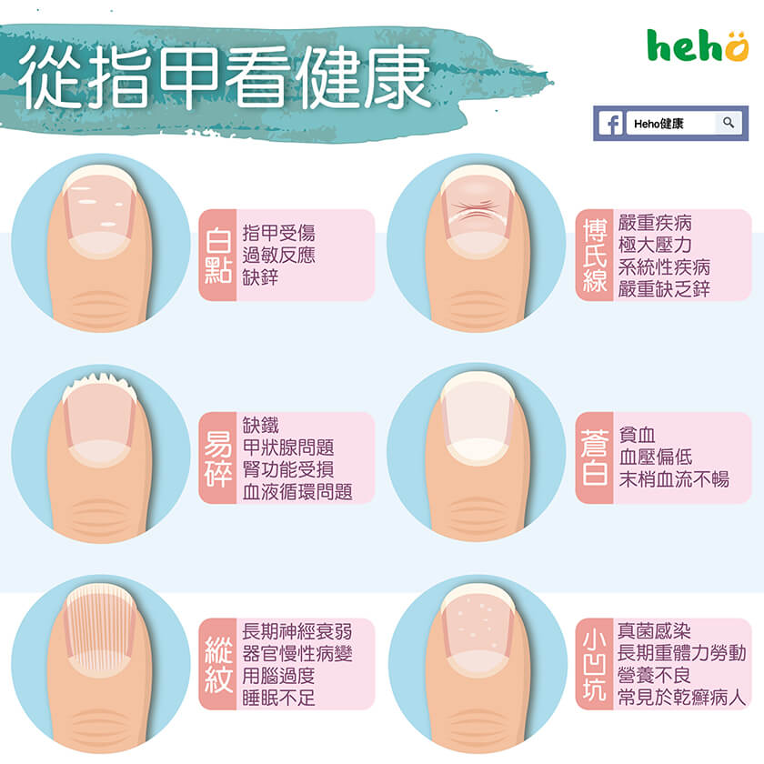 從指甲看你身體可能發生什麼問題 Heho健康