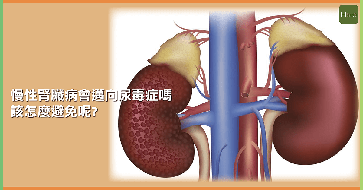 慢性腎臟病會邁向尿毒症?該怎麼避免 Heho健康