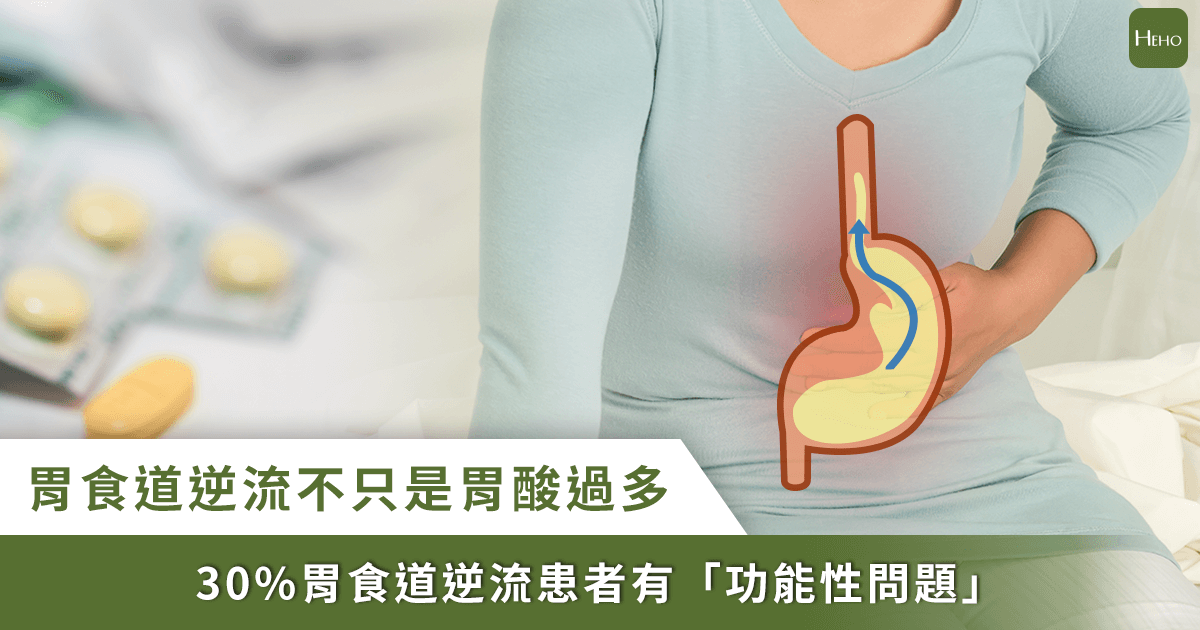 30胃食道逆流患者胃藥白吃了!症狀沒改善需要這2個檢查 Heho健康